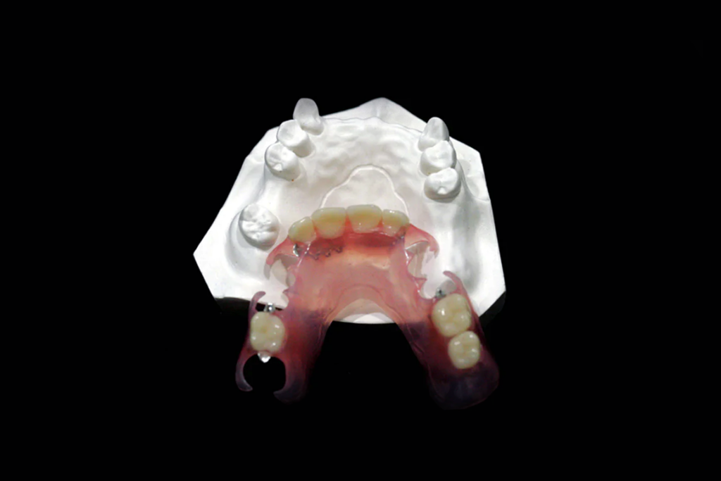 Dentures and Partials – PRODIRECT Dental Laboratory