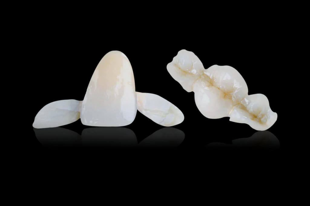 Crowns and Bridges – PRODIRECT Dental Laboratory