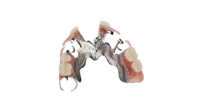 Metal Partial Denture – PRODIRECT Dental Laboratory