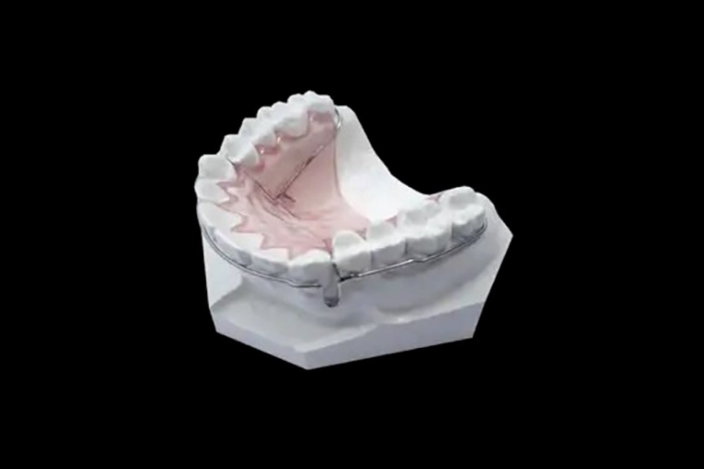 Retainer Appliance – PRODIRECT Dental Laboratory