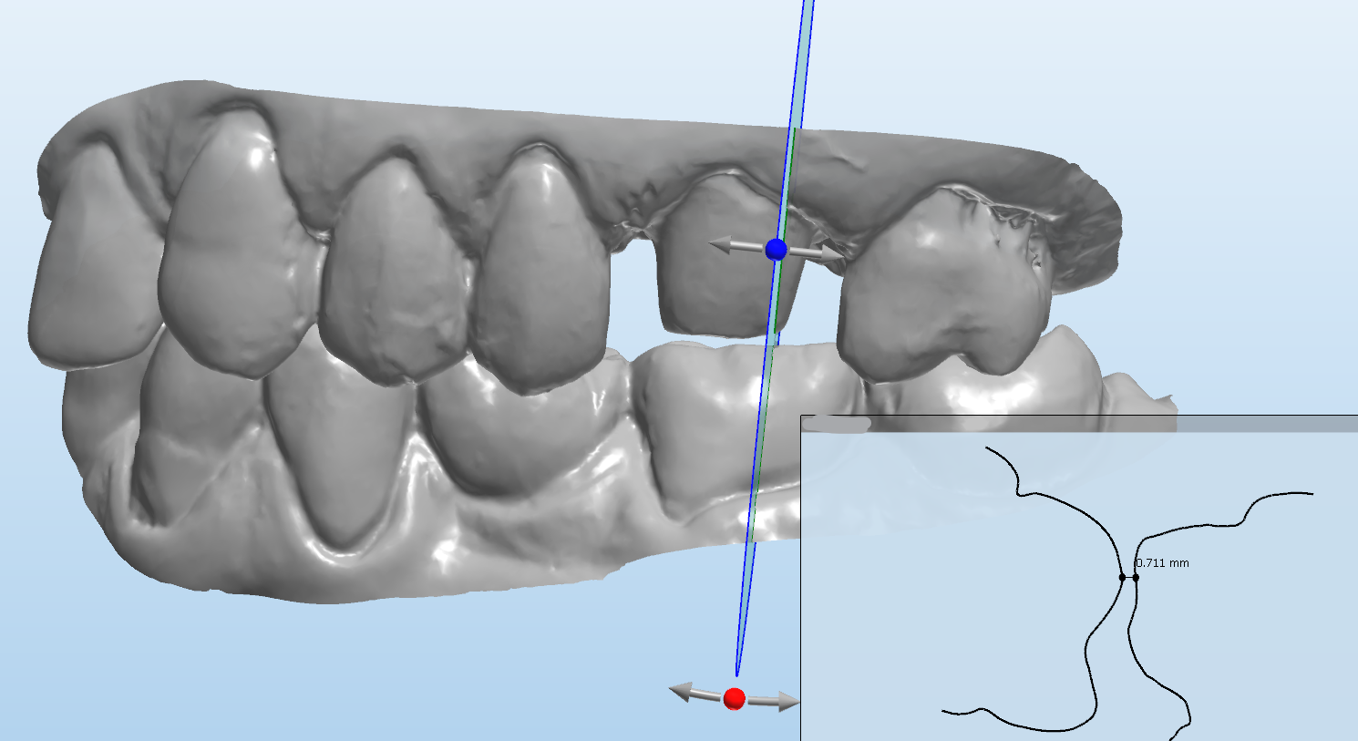 Our Technology - ProDirect Dental Lab